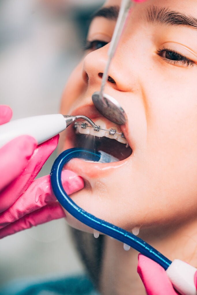 Dental Hygienist Cardiff | 5* Smile Aesthetics By Jamie